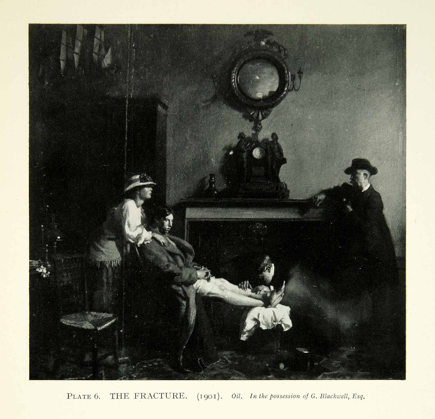 1923 Print Sir William Orpen Realism Art Portrait Foot Leg Fracture XA ...