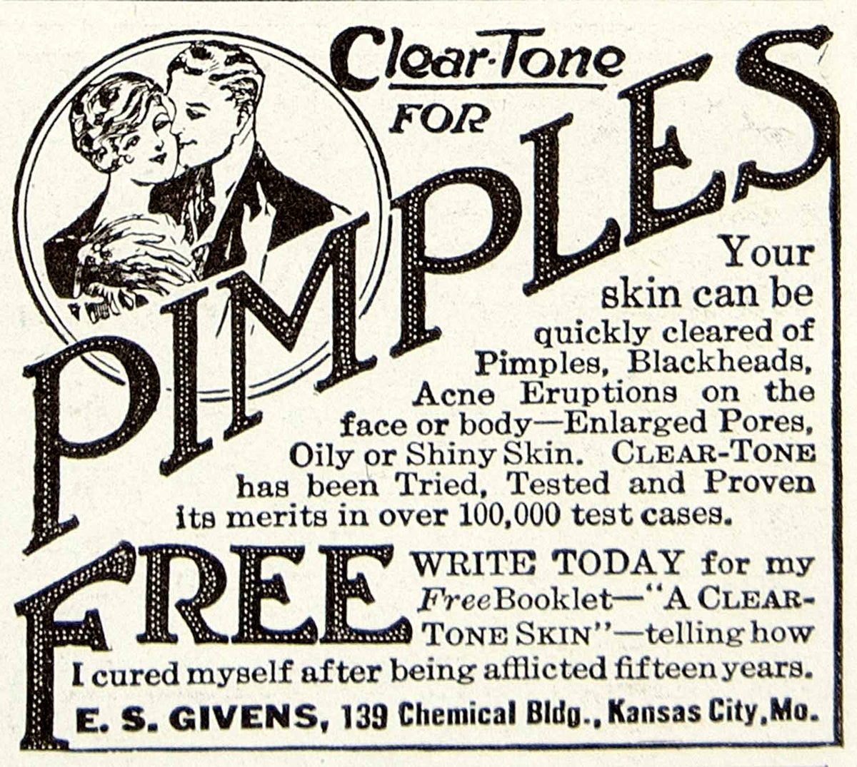 1922 Ad Clear-Tone Pimple Treatment Blackheads Zits Acne Oily Skin E ...